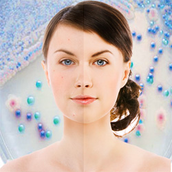 Candida the Cause of Skin Problems